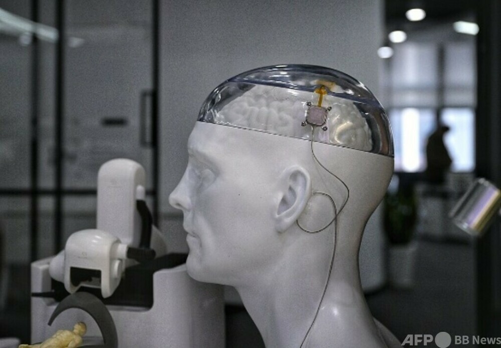 中国初 ブレイン・マシン・インタフェース医療サービスの価格発表 写真1枚 国際ニュース：AFPBB News