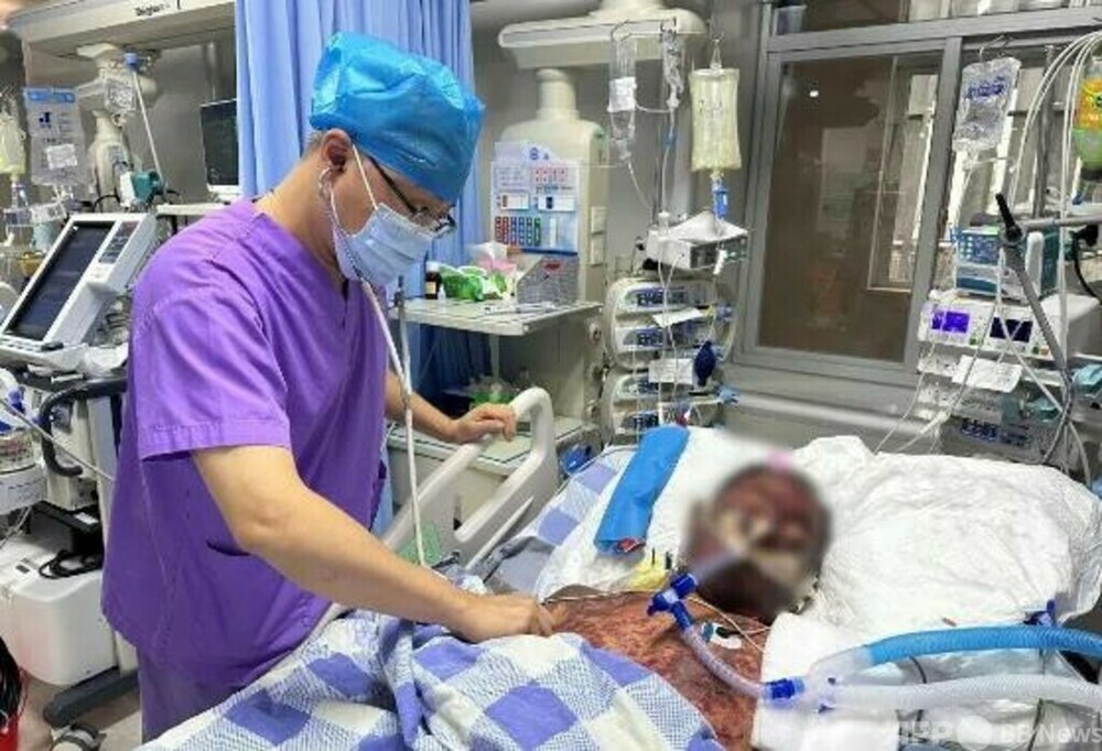 中国広東省の男性 豚肉に触れ点状出血でICUに入院 写真1枚 国際ニュース：AFPBB News