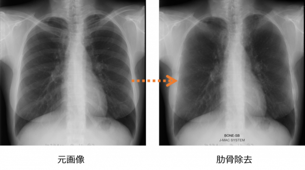 AIで画像処理、医師の読影をサポート 写真1枚 国際ニュース：AFPBB News