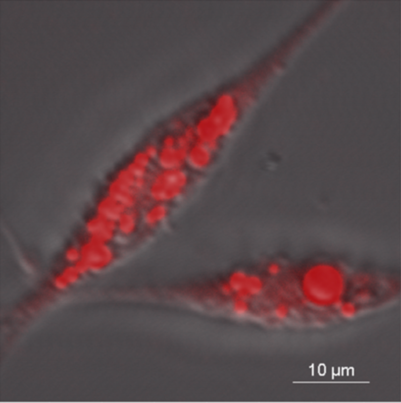 世界初、ウナギの脂を連続生産できる細胞の樹立に成功 写真1枚 国際ニュース：AFPBB News