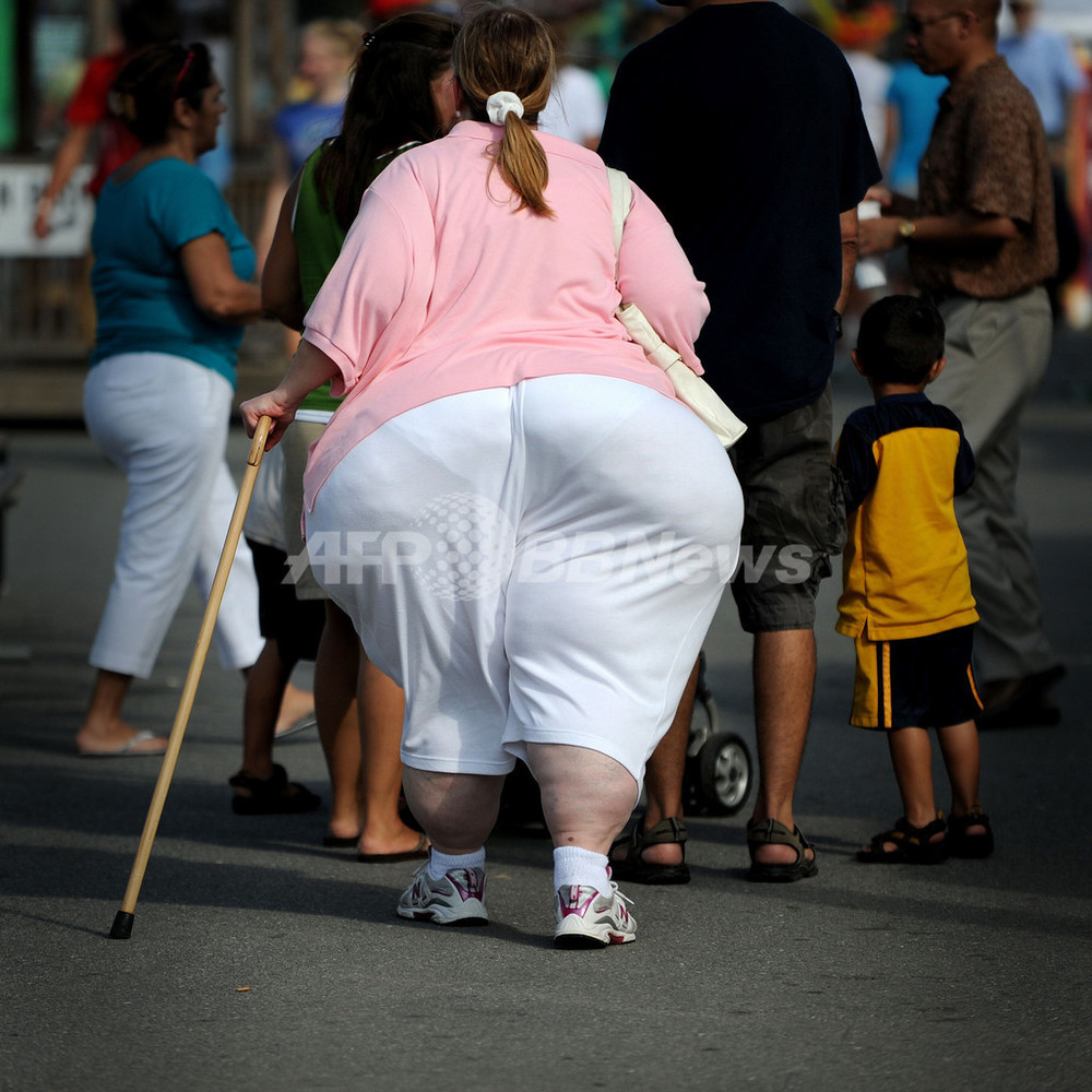 米国の深刻な肥満事情、医療費1500億ドルが肥満治療に 写真5枚 国際ニュース：AFPBB News