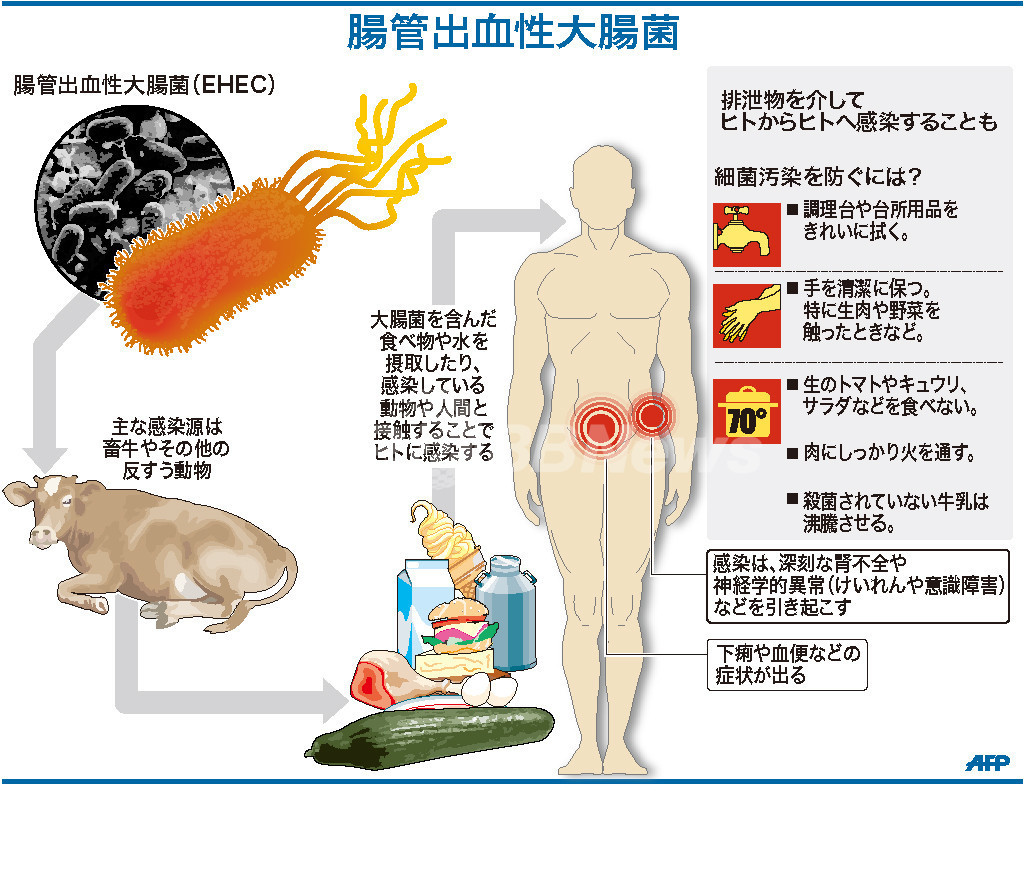 【図解】腸管出血性大腸菌 写真1枚 国際ニュース：AFPBB News