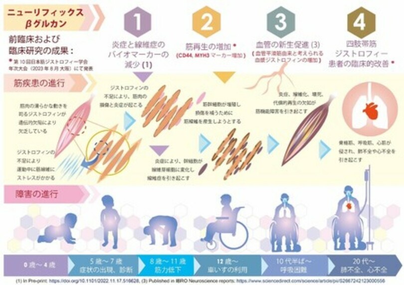 Neu REFIX ー 日本産ベータグルカンが肢帯型筋ジストロフィーに有用であることを証明 写真1枚 国際ニュース：AFPBB News
