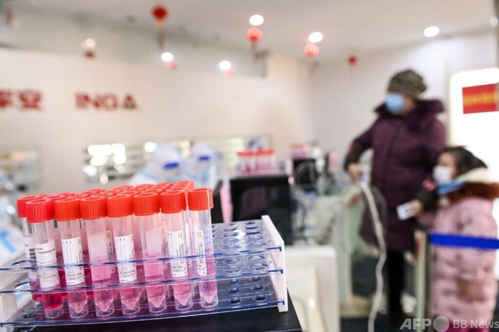中国の1日当たりのPCR検査能力が4609万件に 写真1枚 国際ニュース：AFPBB News